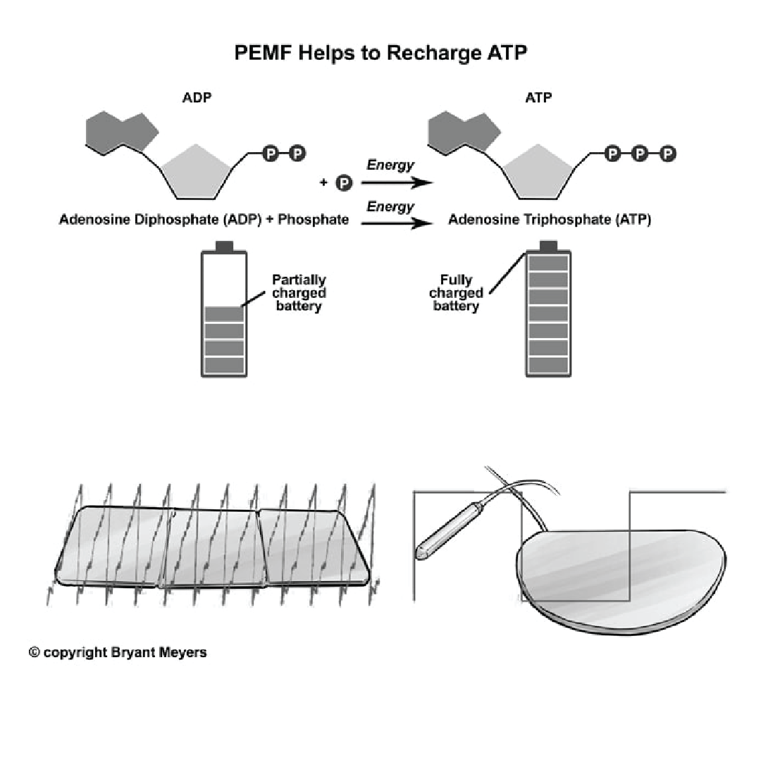 What is PEMF? - Official Website for iMRS2000